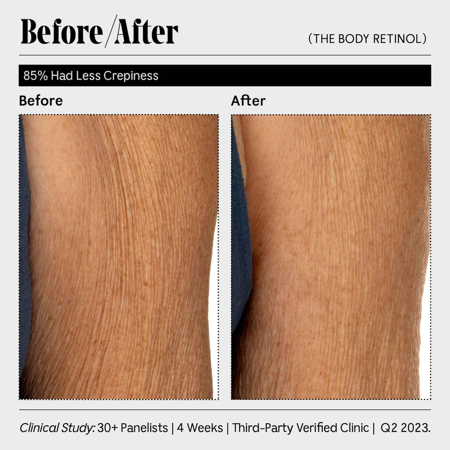 The Body Retinol - Repair Serum With 0.1% Pure Retinol, 10% Aha + 5 ...