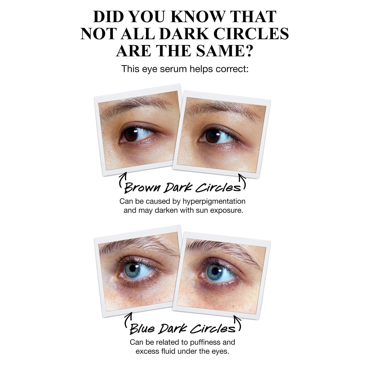 Vitamin c for dark circles store