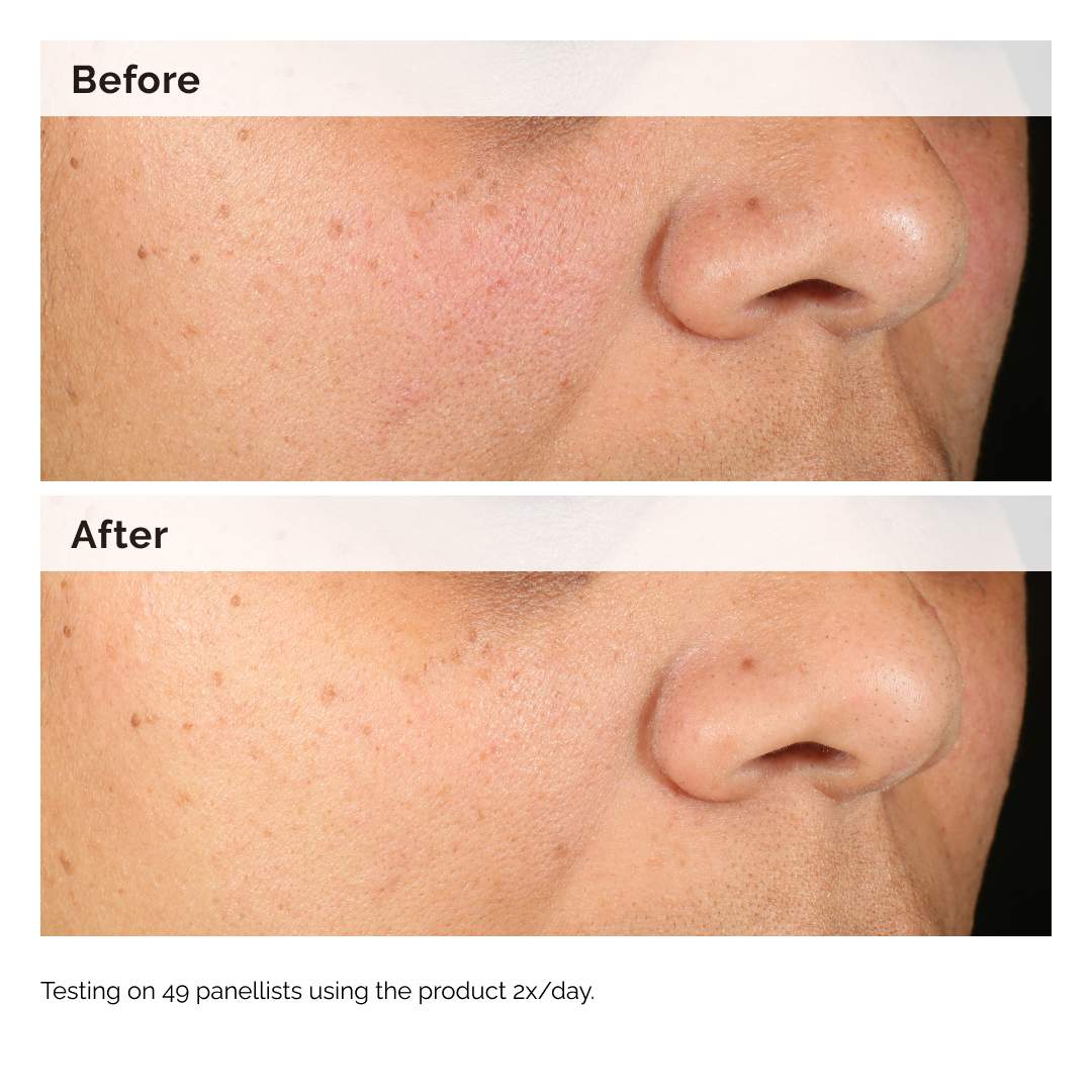 Alpha Arbutin 2% + Ha Hyperpigmentation Serum | Men's Health Shop